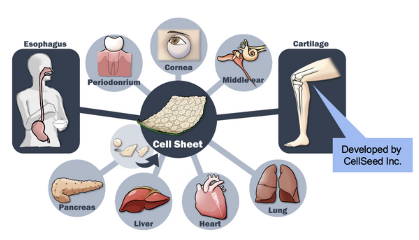Cell Sheet Engineering for Cartilage Regeneration in Japan – THE ACTO TIMES
