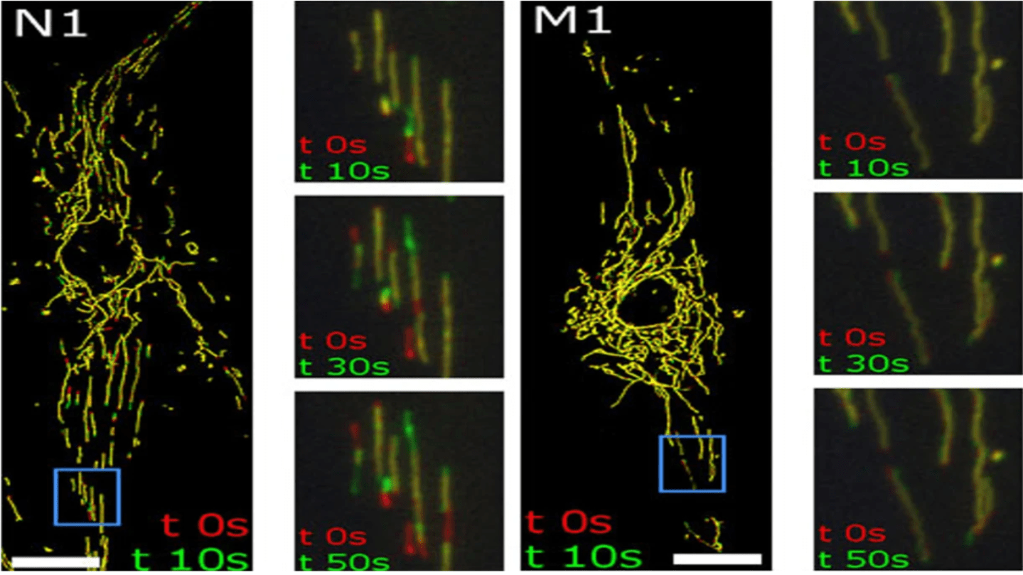 Oxidative stress-driven metabolic reprogramming failure in MERRF ...